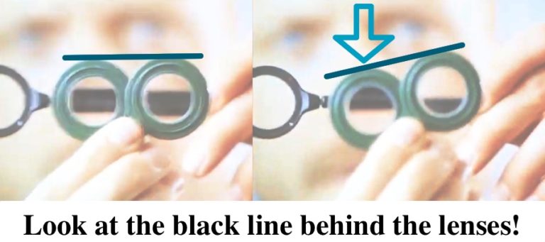 Troubleshooting Progressive Lens Problems Troubleshooting Progressive Lens Problems