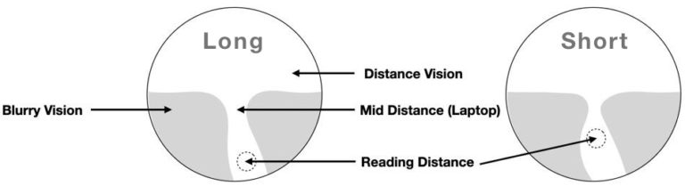Experiences with the Hoyalux ID MySelf – An Owner’s Review