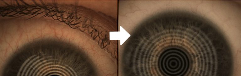 10 Tips for Whiter and Brighter Eyes (The Natural Way)